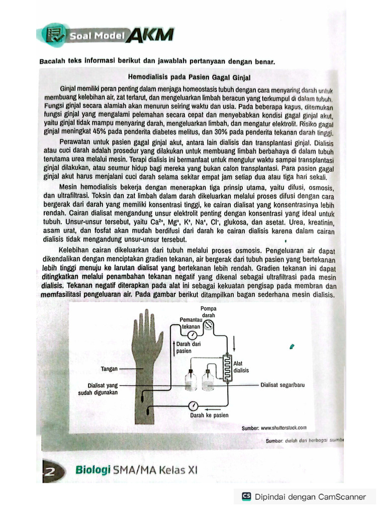 Artikel Cuci Darah Htzrsyfyfydydufuguufug | PDF