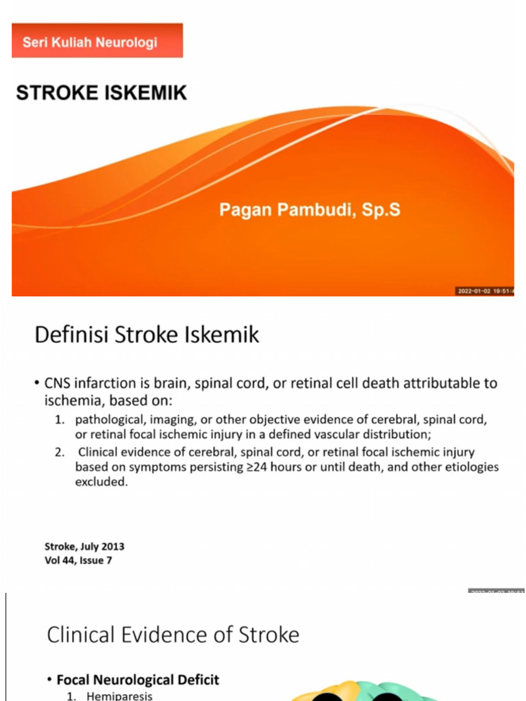 Stroke Iskemik | PDF
