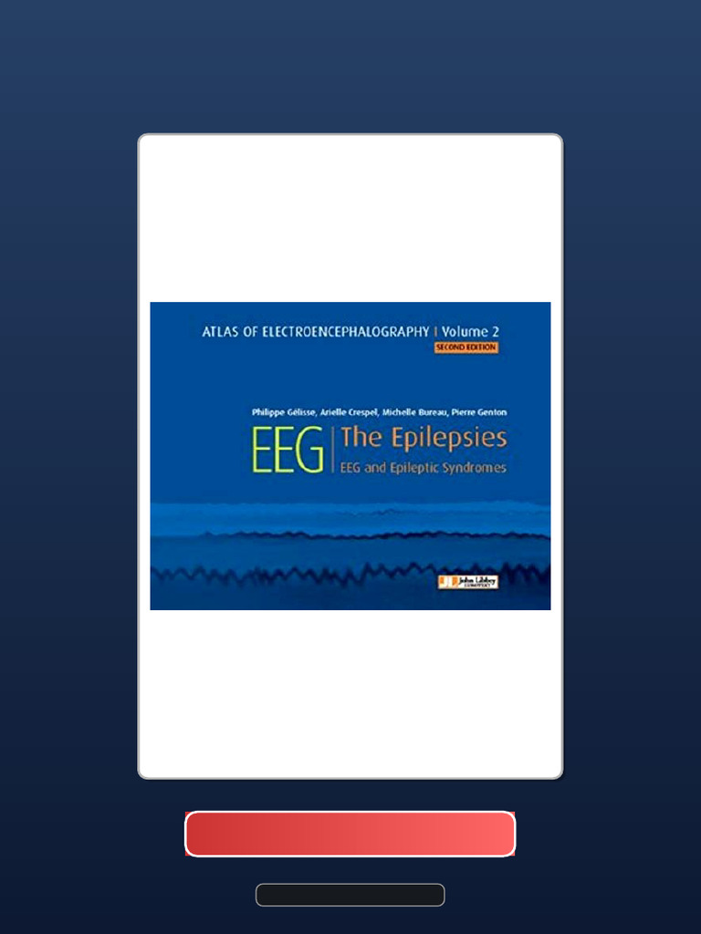 Atlas of ElectroencephalographyThe Epilepsies EEG and Epileptic ...