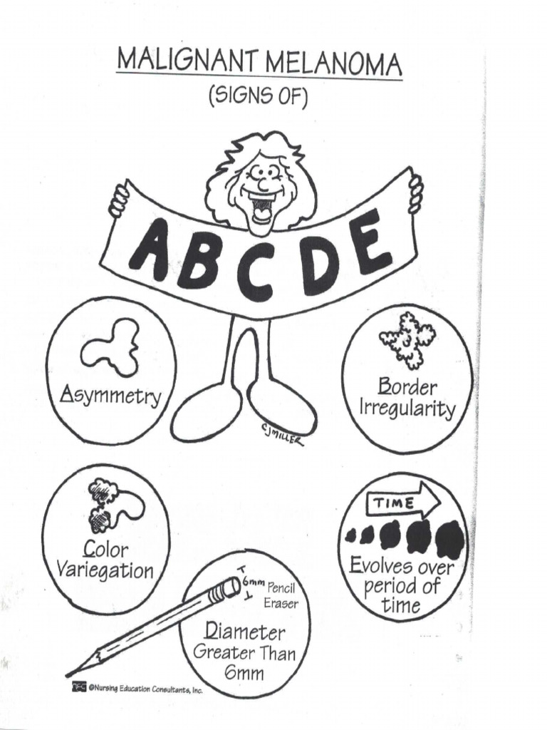 ABCDE of Malignant Melanoma Colouring Page | PDF