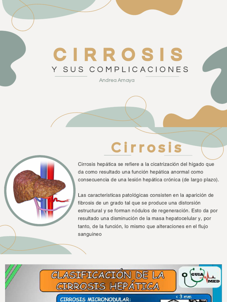 Cirrosis Hepatica Medicina Interna | PDF | Cirrosis | Hepatitis