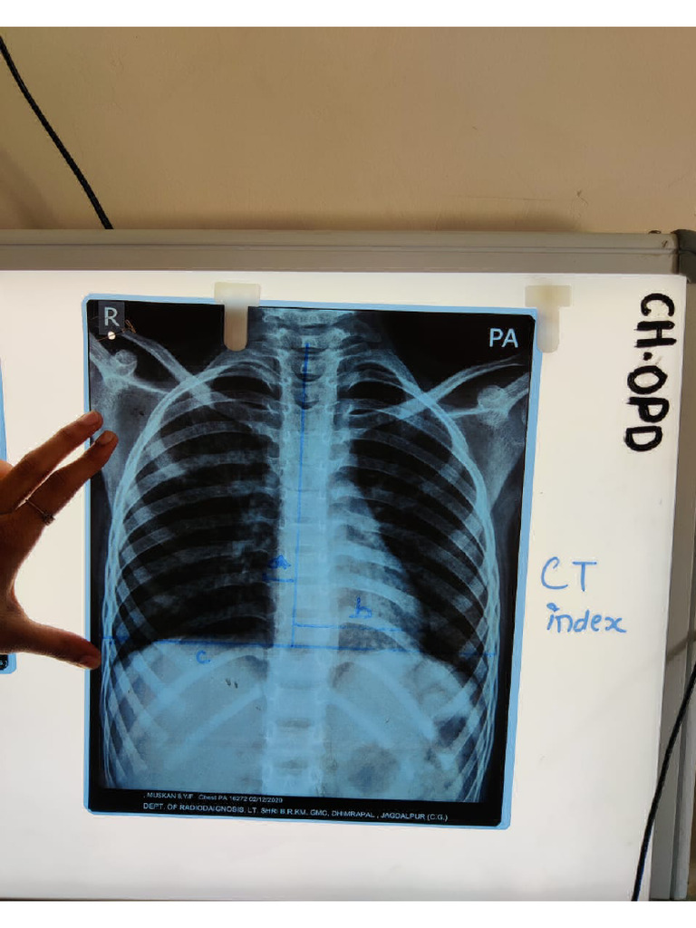 Pediatric Xrays PDF | PDF