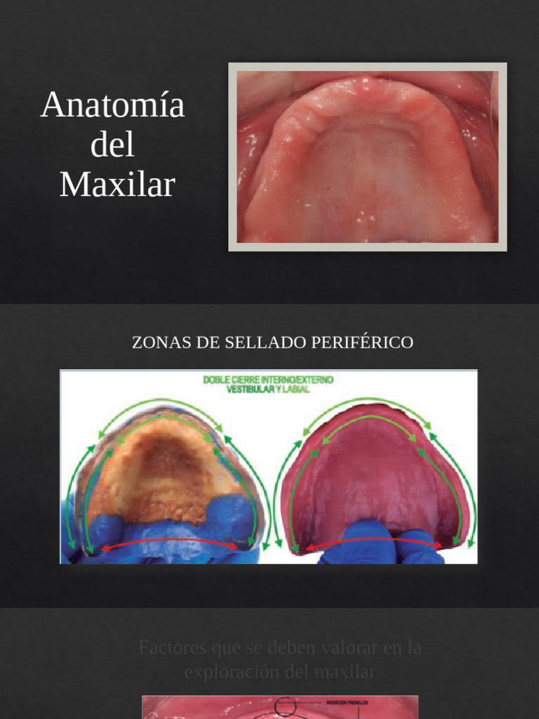 Anatomía del Maxilar Inferior Edéntulo | PDF