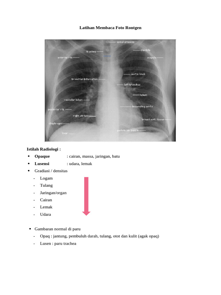 Analisis Foto Rontgen Thorax dan Abdomen | PDF