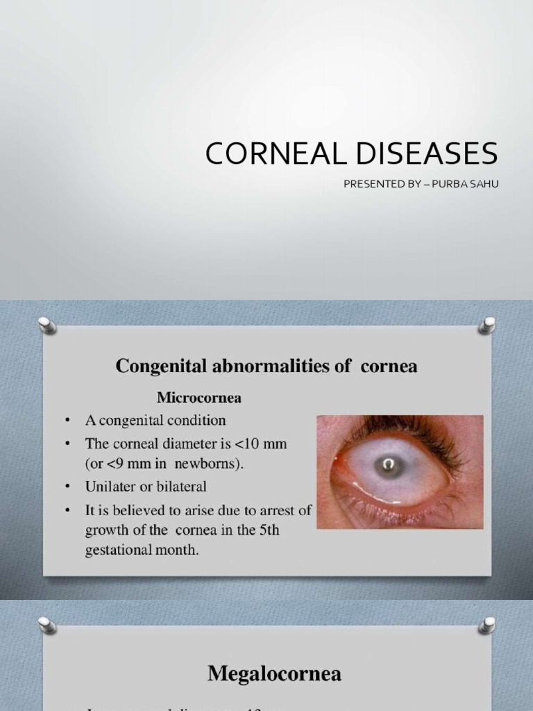 Corneal Abnormalities | PDF