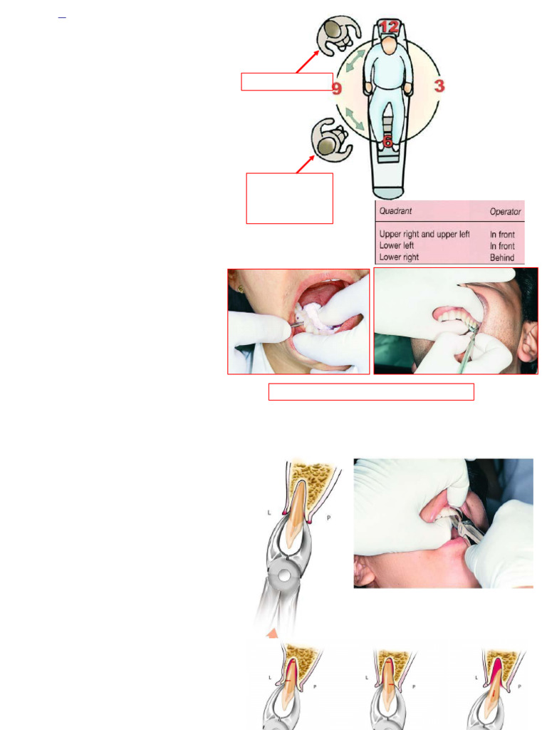 Dentist's Guide to Tooth Extraction Techniques | PDF | Dental Anatomy ...