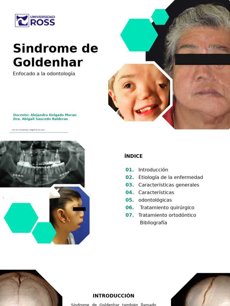 Sindrome de Goldenhar | PDF | Ortodoncia | Especialidades Medicas