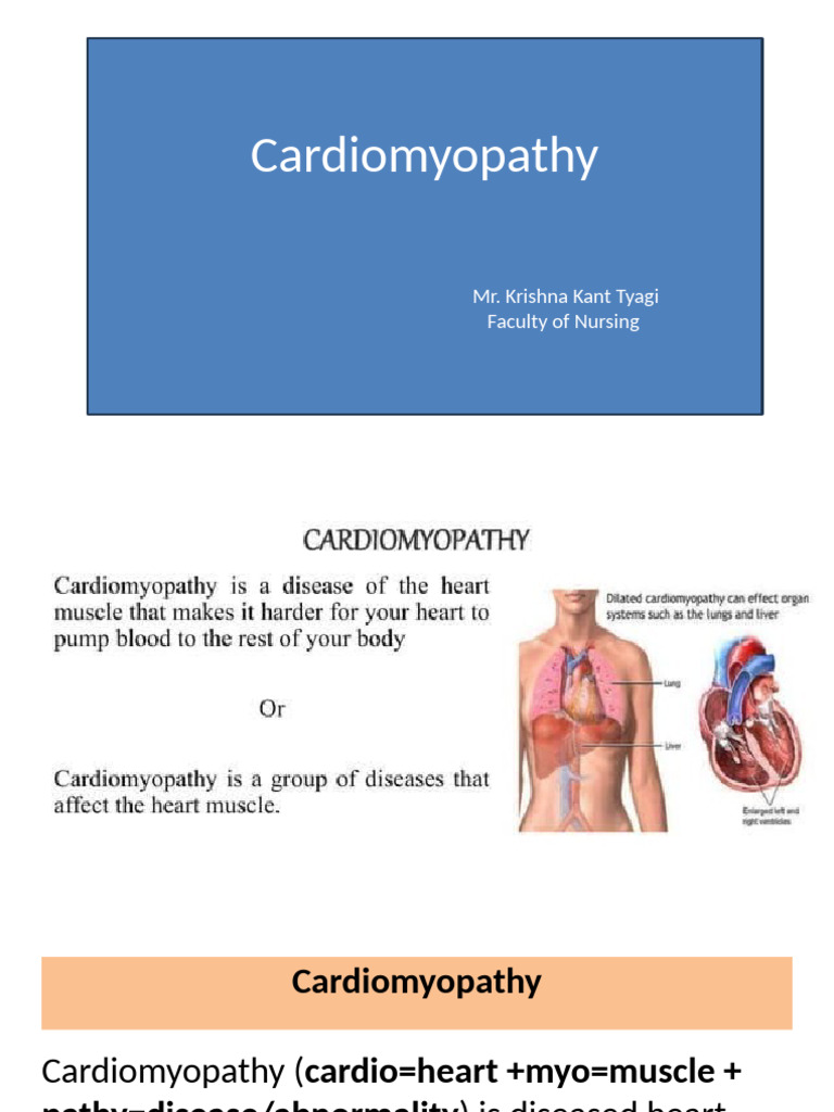 Cardiomyopathy | PDF