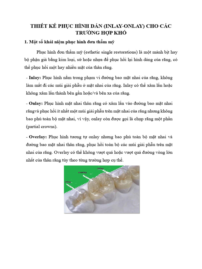 Bài 2 Thiết kế phục hình dán inlay onlay cho các trường hợp khó | PDF