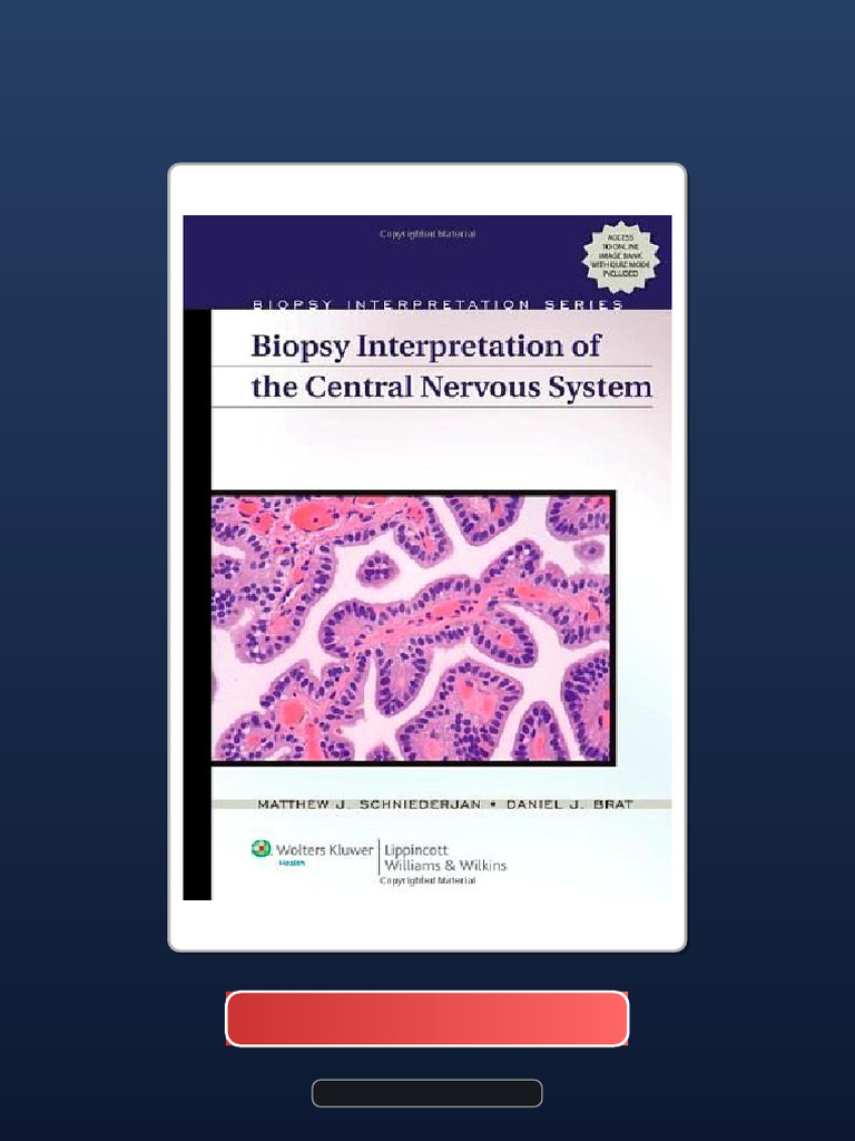 Biopsy Interpretation of The Central Nervous System Biopsy Interpretation Series Full Download ...