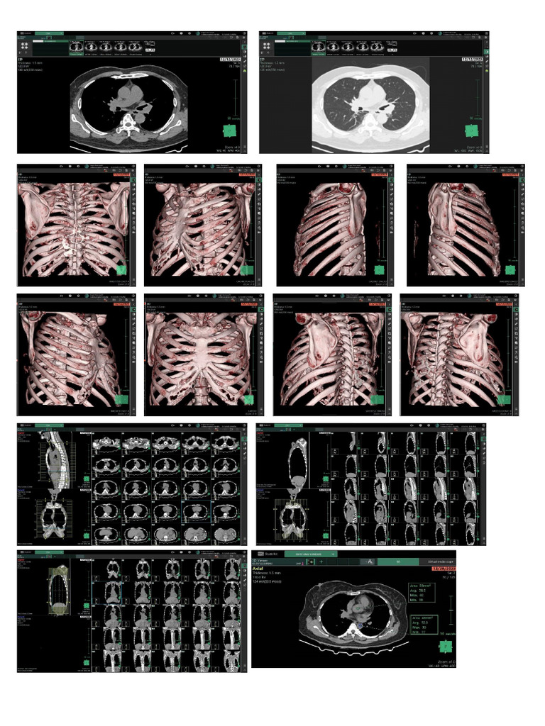 Thorax, Abdomen Print | PDF