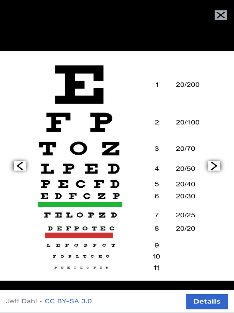 Snellen Chart - Wikipedia | PDF