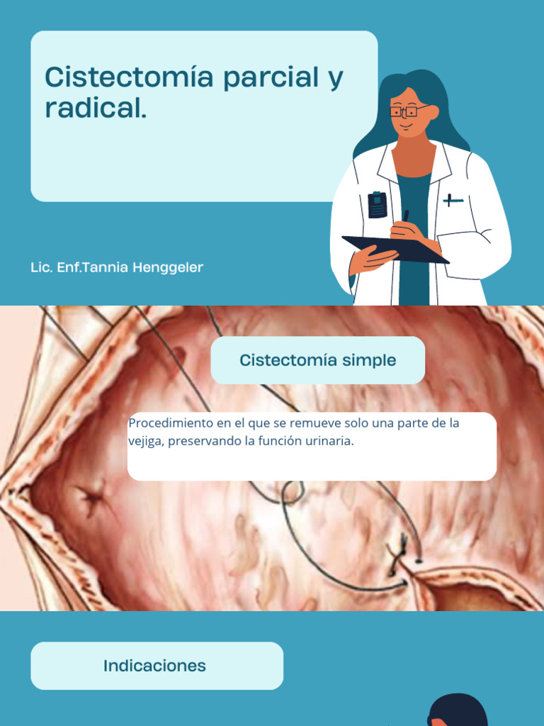Cistectomía Parcial y Radical - PDF 2 | PDF | Especialidades Medicas | Medicina CLINICA