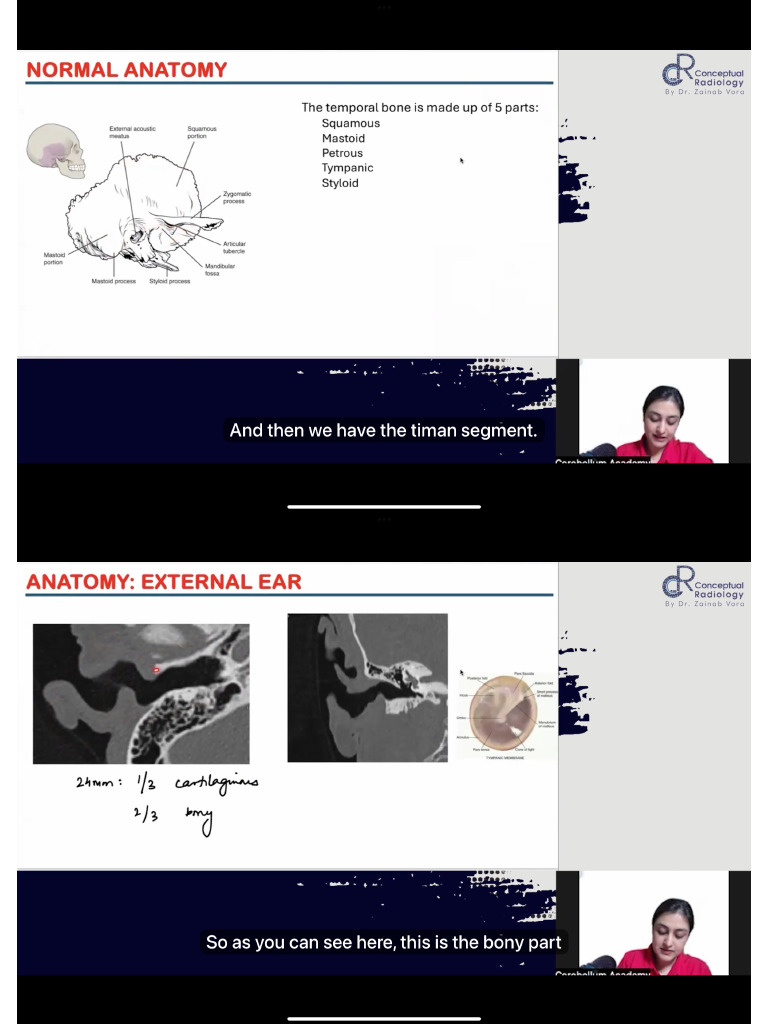 HRCT Temporal Bone | PDF