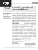 Ventricular Tachycardia - Monomorphic VT - LITFL | PDF ...