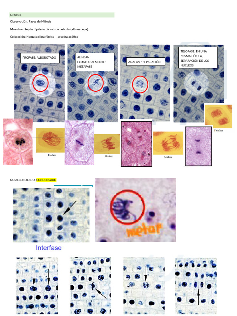 Fases de Mitosis en Microscopio | PDF