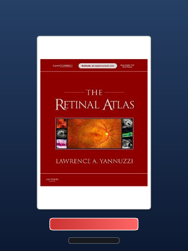 Complete Bundle the Retinal Atlas eBook and TestBank Bundle | PDF