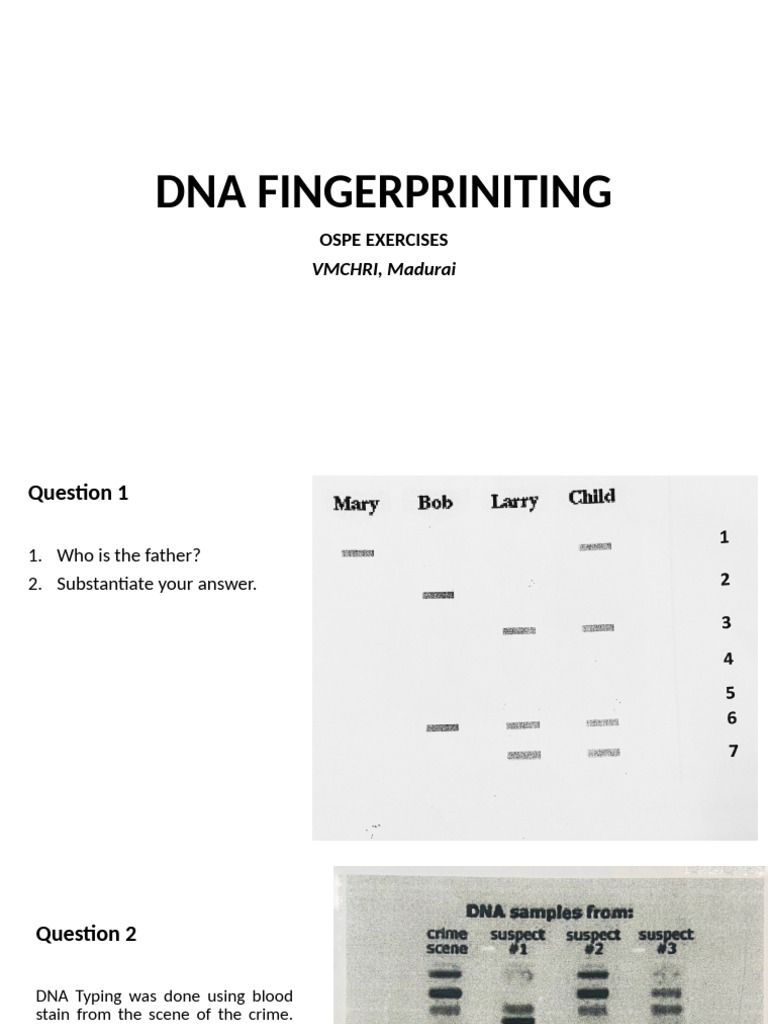 DNA Fingerprinitng OSPE | PDF