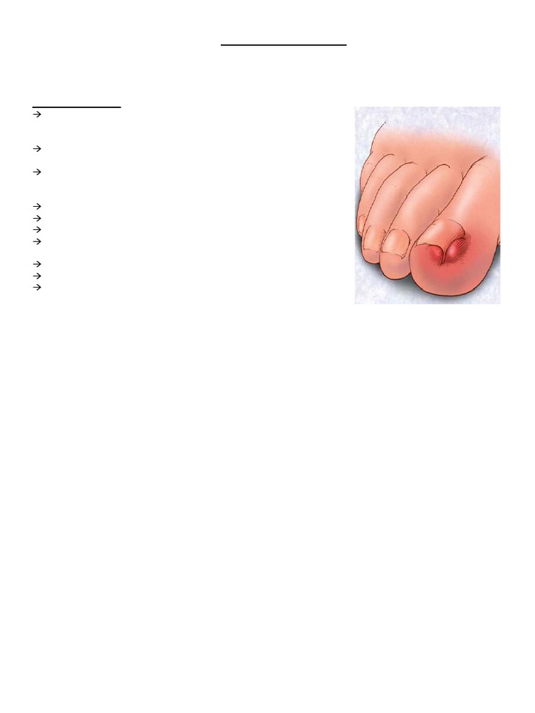 Onicocriptosis: Causas y Tratamiento | PDF | Clavo (anatomía ...