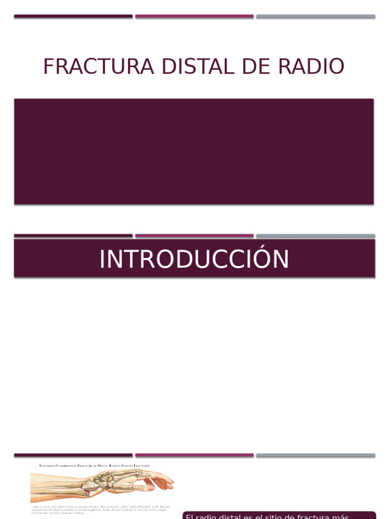 Fractura Distal de Radio: Manejo y Tratamiento | PDF | Mano | Fractura