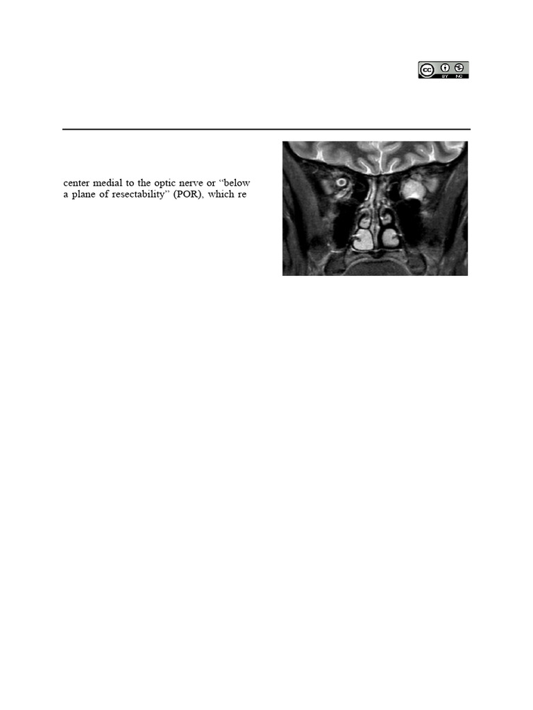 Endoscopic Approach To Intraconal Tumours - Surgical Anatomy and ...