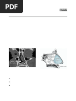 Antral Puncture and Lavage Procedure | PDF | Human Nose | Human Head ...