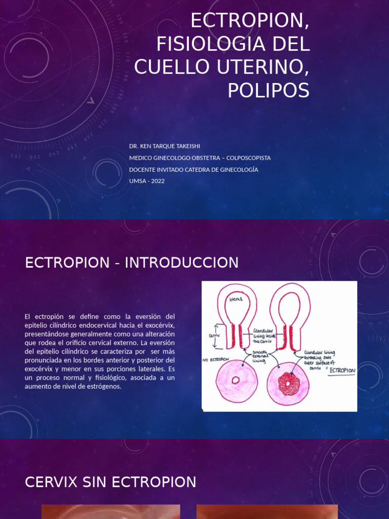Ectropión y Pólipos Cervicales | PDF | Especialidades Medicas ...
