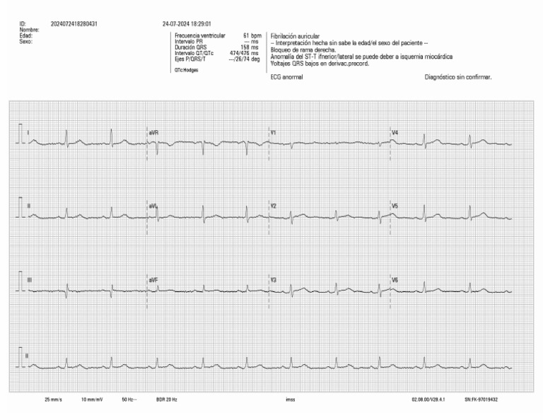 Ecg C5 | PDF