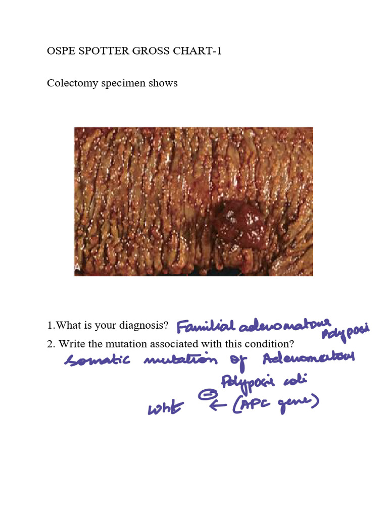 Ospe Spotter Gross Charts - 250626 - 003615 | PDF