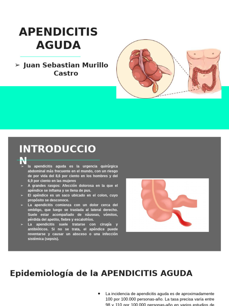 Apendicitis Aguda | PDF | Medicina CLINICA | Especialidades Medicas