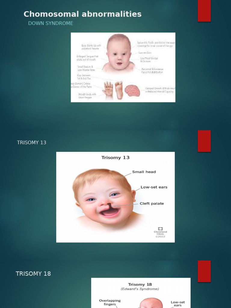 Chomosomal Abnormalities | PDF