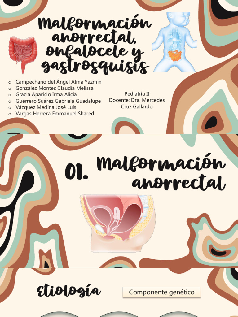 Malformación Anorrectal, Onfalocele, Gastrosquisis | PDF | Vagina | Abdomen