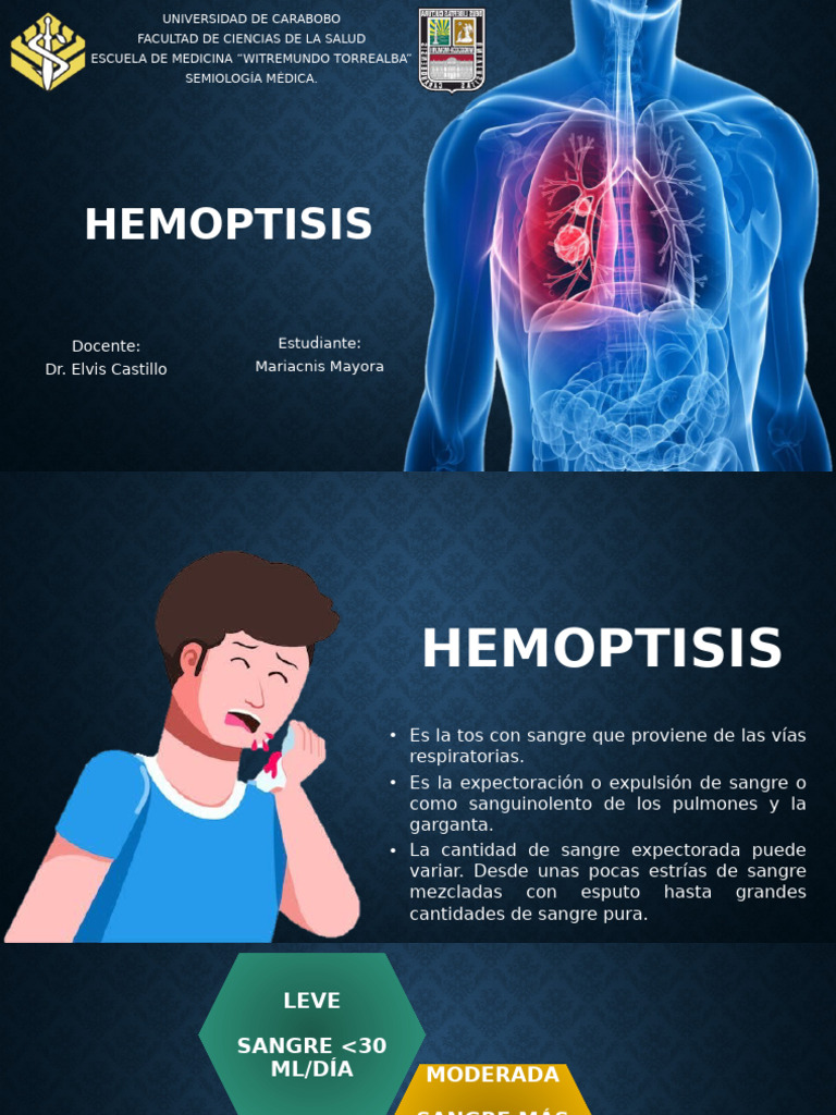 HEMOPTISIS | PDF | Medicina | Enfermedades y trastornos humanos