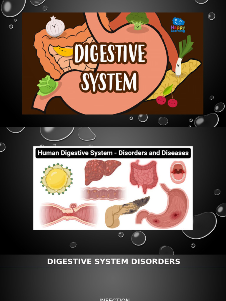 Lesson 5 Digestive System Disorders | PDF | Gastroesophageal Reflux Disease | Esophagus