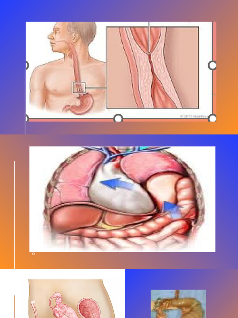 Recode Imagenes 2do Sem. | PDF