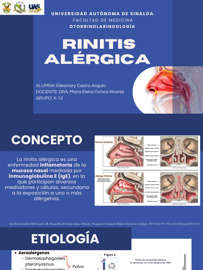Rinitis Alergica | PDF | Alergia | Especialidades Medicas