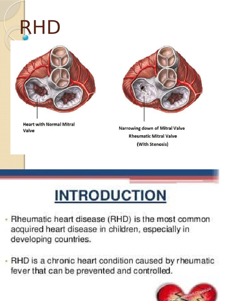 Rheumstic Heart Disease | PDF | Streptococcus | Heart Valve