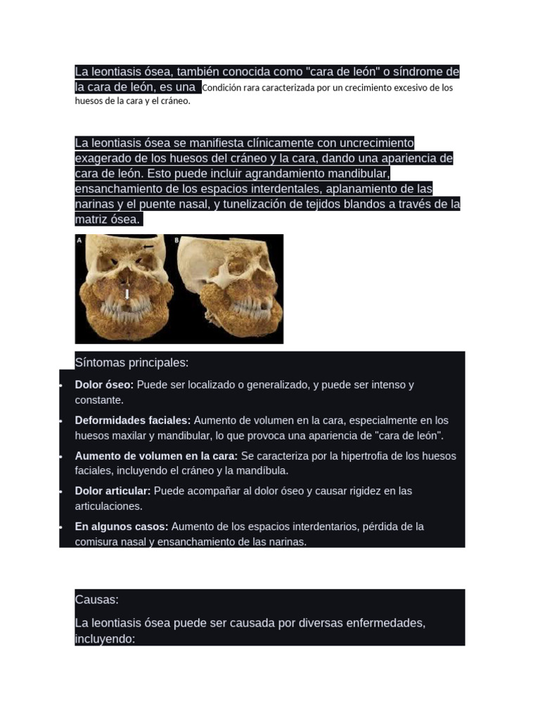 La Leontiasis Ósea | PDF | Hueso | Enfermedades y trastornos