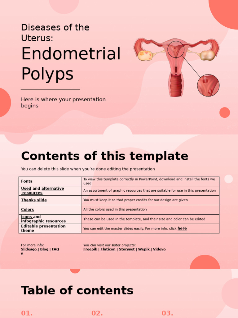 Diseases of The Uterus - Endometrial Polyps by Slidesgo | PDF | Medical ...