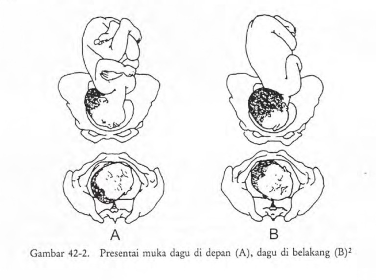 Presentasi Muka Dan Dagu | PDF