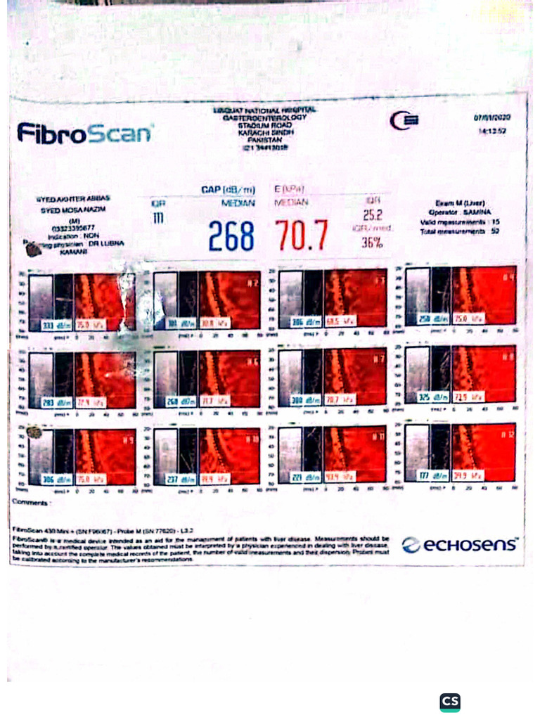 Abu Old Fibroscan | PDF
