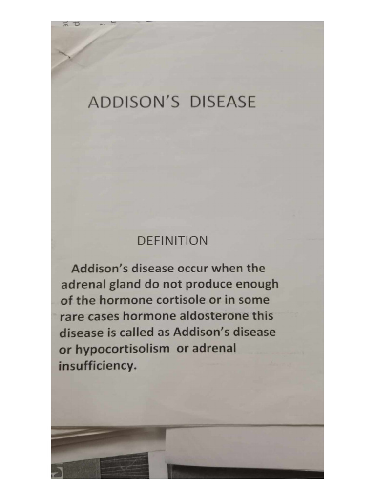 Addison's Disease | PDF