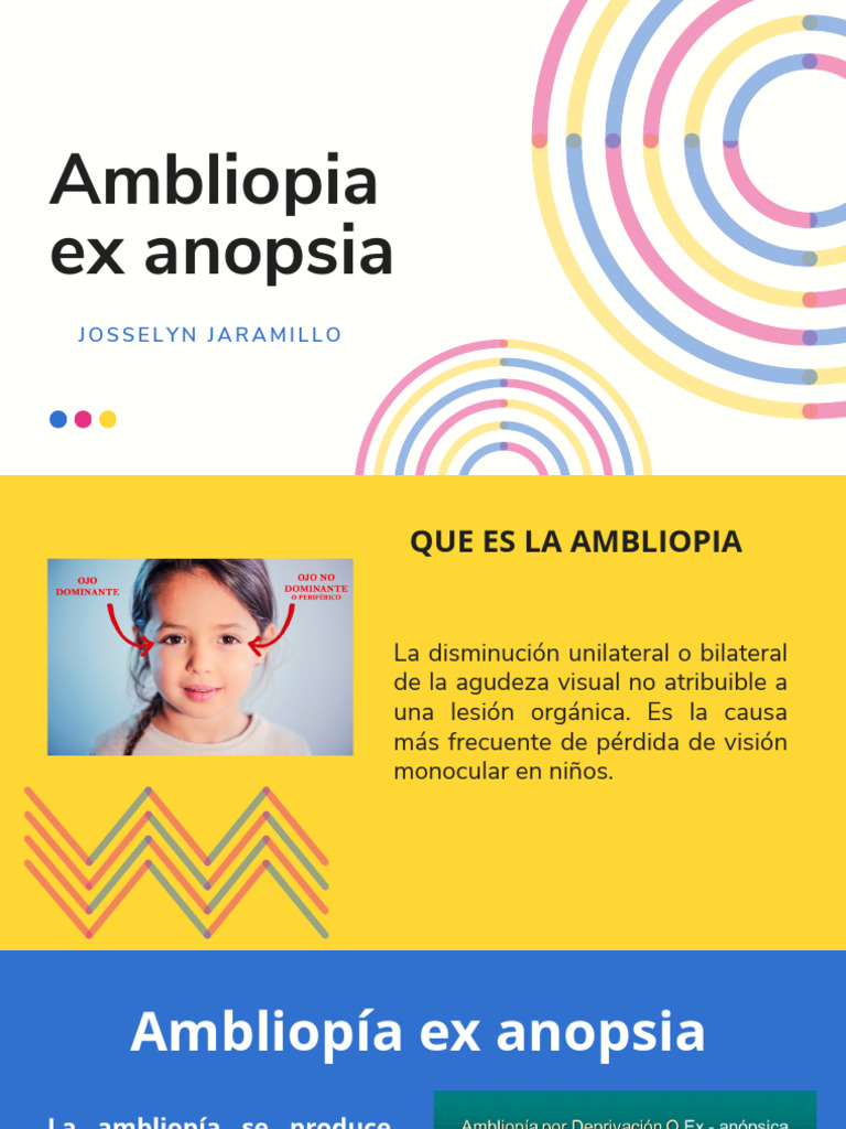 Ambliopía Ex Anopsia: Definición y Causas | PDF