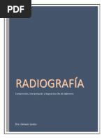 Signos de neumoperitoneo en radiografías | PDF | Abdomen | Hígado
