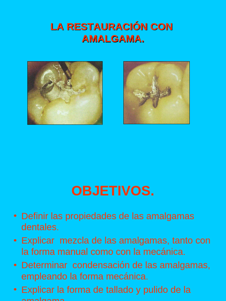 Amalgamas Preparacion y Restauracion | PDF | Aleación | Cobre