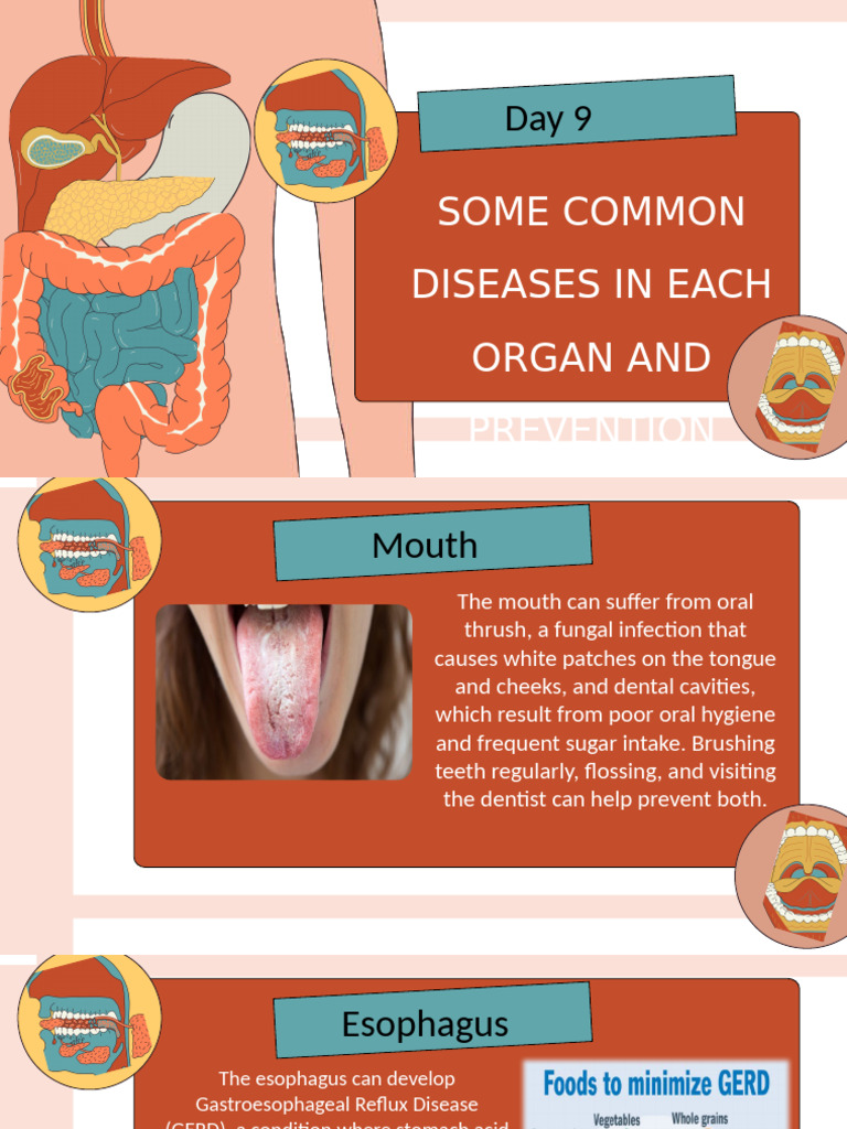 LC 1 2 1 Some Diseases and Prevention | PDF | Gastroesophageal Reflux ...