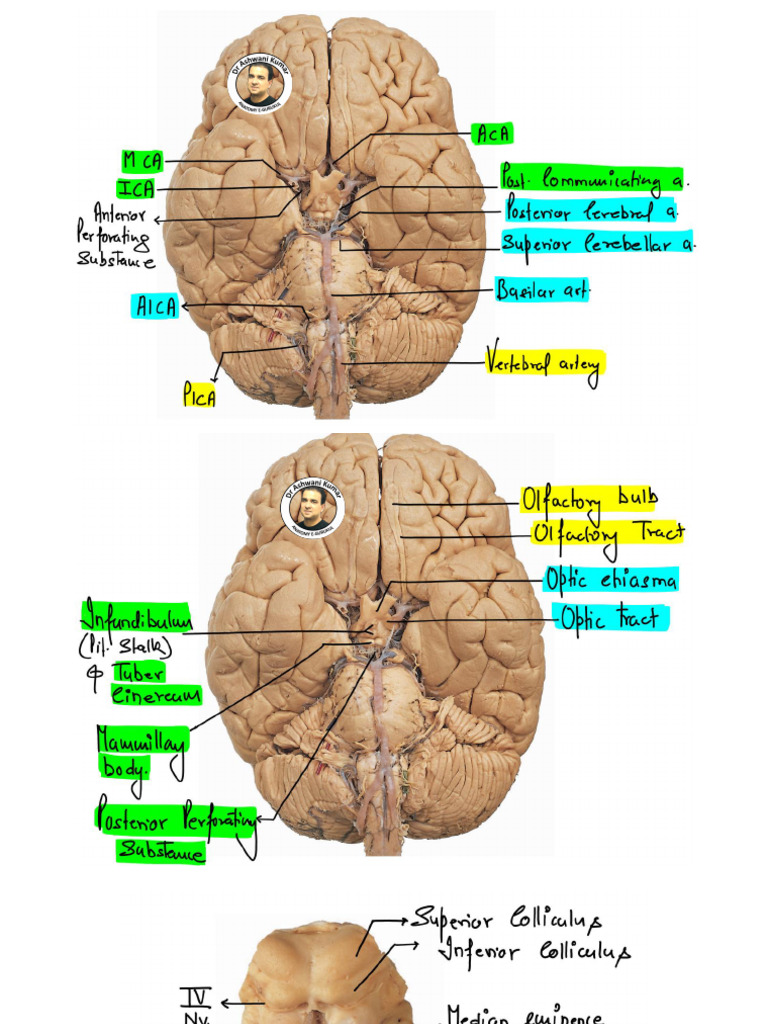 Images Neuroanatomy Ashwani Kumar | PDF