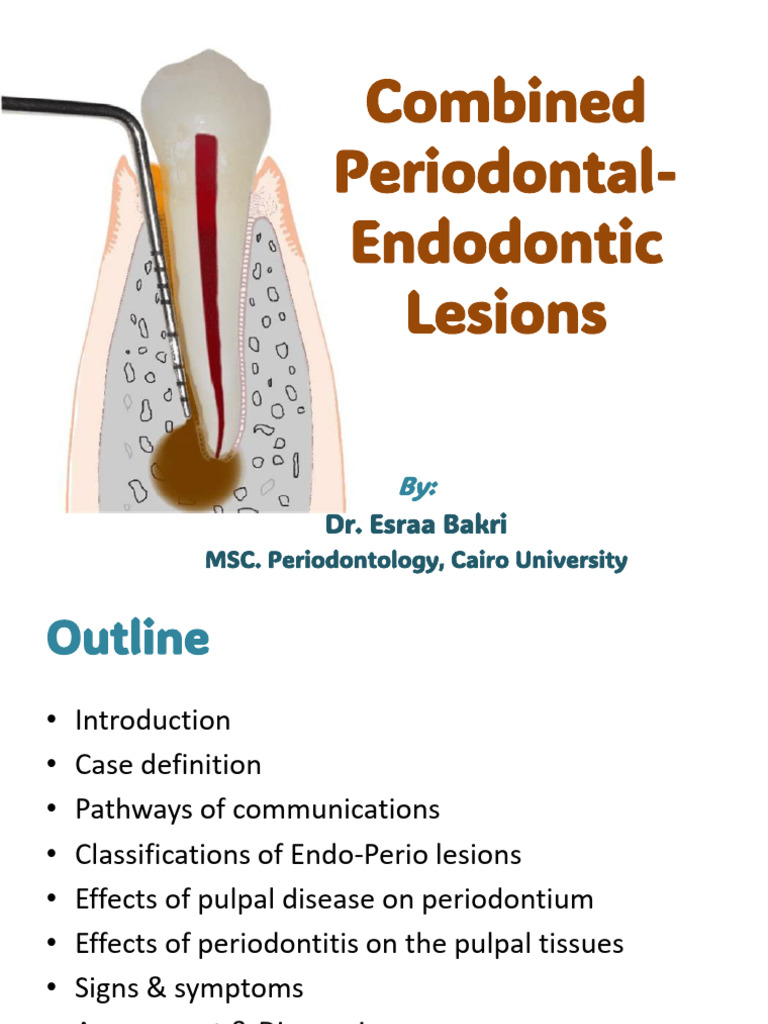 Endo-Perio Lesions: Diagnosis & Treatment | PDF | Periodontology | Tooth