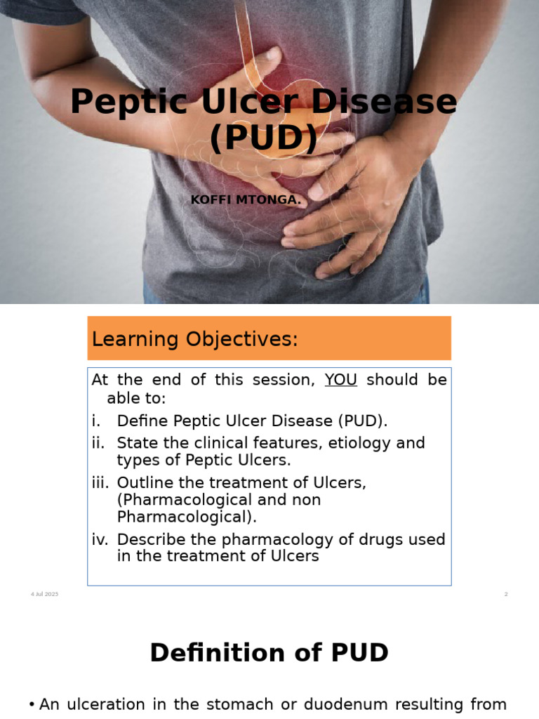 Peptic Ulcer Disease Overview and Management | PDF | Gastroesophageal ...