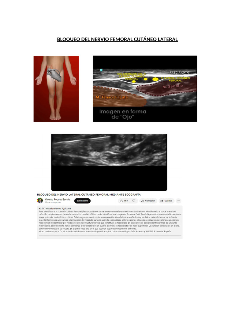 Fem Cut Lat | PDF